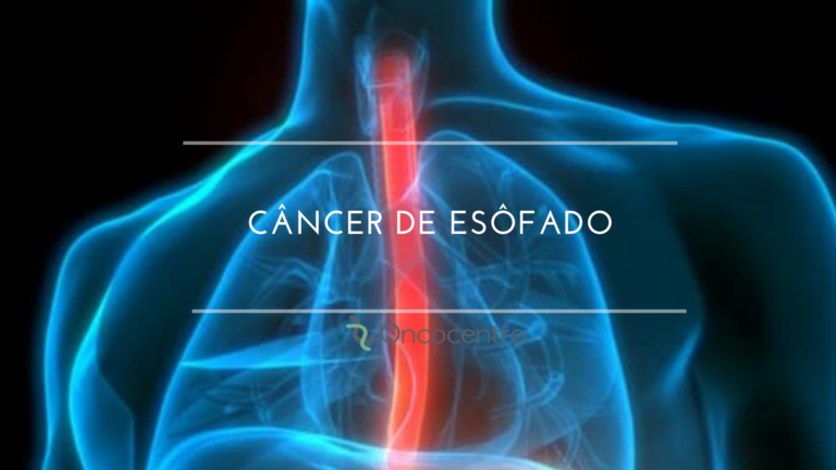 Câncer de Esôfago | Oncocentro